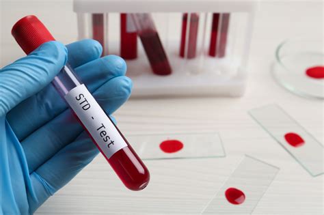understanding std testing what you need to know nextmed clinic