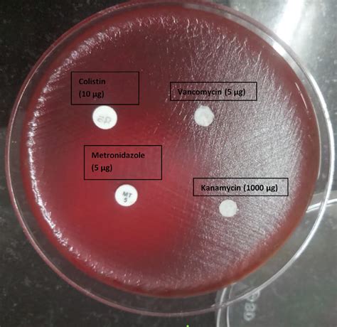 Identification Of Bacteroides Fragilis Group Using Discs Vancomycin 5 Download Scientific