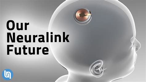 Are We Ready For Elon Musks Neuralink Future