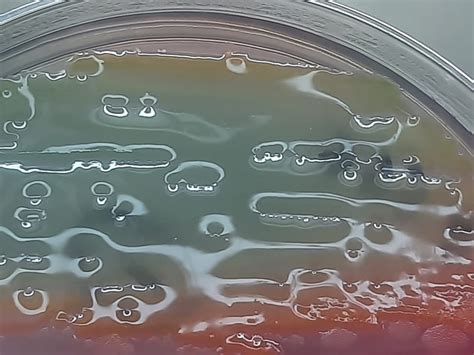 Klebsiella Ozaenae Infection Archives Medical Notes