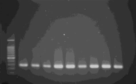 Pcr Of Staphylococcus Aureus Specific Nuc Gene Size 279 Bp Here Download Scientific