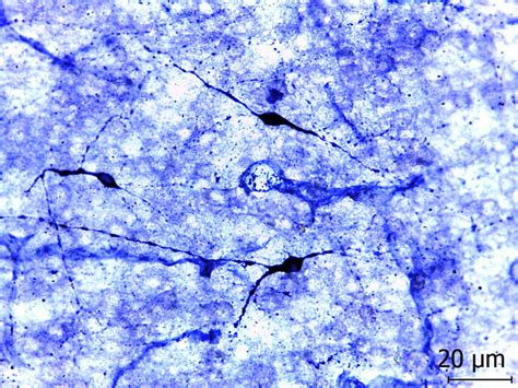 Nadph D Histochemistry Shows Bipolar Nitrergic Neurons With An Axon And
