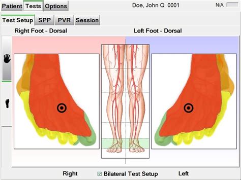Angiosome Guided Testing For Cli