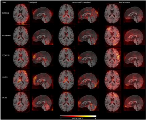 Saliency Maps For 5 Sites Of The Models Trained In Real Data Distribution Download Scientific