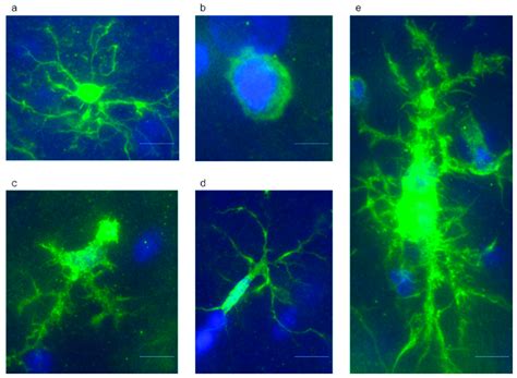 Representative Microphotographs Of Microglial Cells Of Different