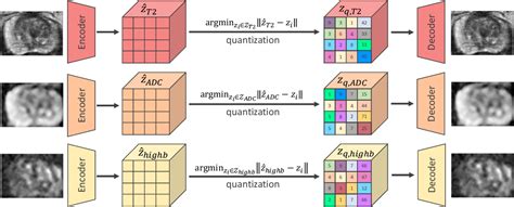 Figure 1 From Codebook Vq Vae Approach For Prostate Cancer Diagnosis Using Multiparametric Mri