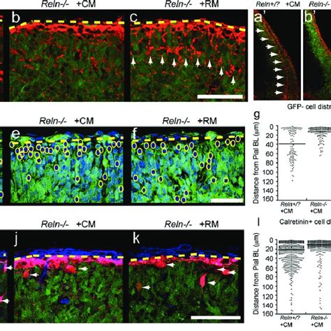 Equivalent Positioning Of L6 Neurons During Preplate Splitting In E13 Download Scientific