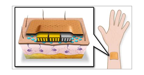 Silicon Micropillar Array Based Wearable Sweat Glucose Sensor Acs Applied Materials And Interfaces