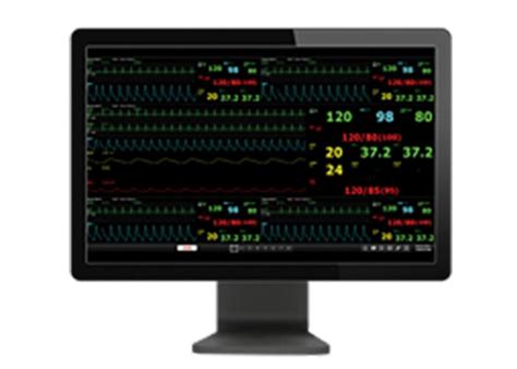 New 2017 Philips Efficia Cms200 For Sale Item 683747 Bimedis