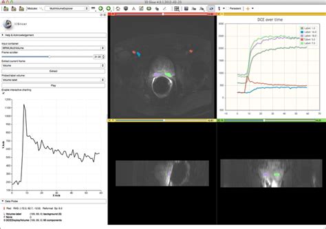 2012 Progress Report Science Wiki Version Engineering Namic Wiki