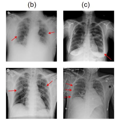 Sample Image Data For Multi Class Classification To Detect A Normal
