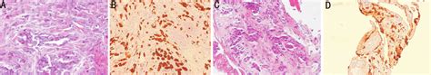 Histopathological Skin Analysis And Immunohistological Analysis Of Lung Download Scientific
