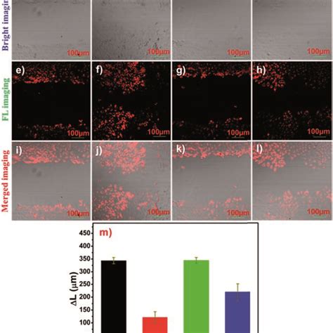 Cell Motility Assays Of Probe Dcm Apn In Hepg 2 Cells The Cellular