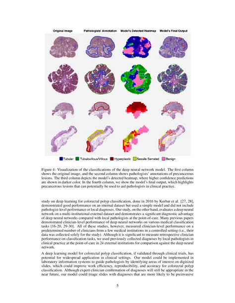 Deep Neural Networks For Automated Classification Of Colorectal Polyps