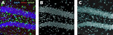 Complex Cell Segmentation And Its Significance In Spatial Biology