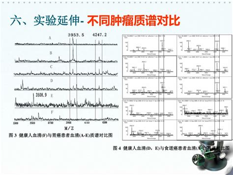 Ppt 多维色谱与 Maldi Tof Ms 联用技术 对人血清中低丰度蛋白的分离与鉴定 Powerpoint Presentation Id 5992122