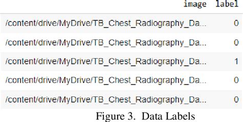 Figure 3 From Classification Of Tuberculosis Based On Lung X Ray Image With Data Science