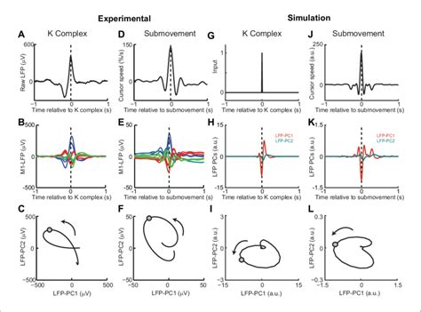 Simulated Lfp Dynamics During Movement And Sedation A K Complex