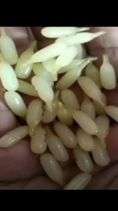 Conjunctiveshealthcare Healthtips Healthylifestyle Youtube