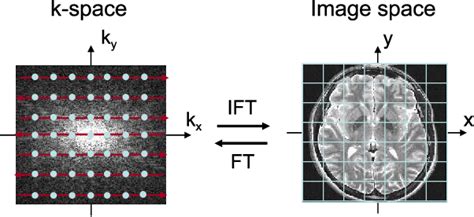 Figure 1 From The Statistical Analysis Of Fmri Data Semantic Scholar