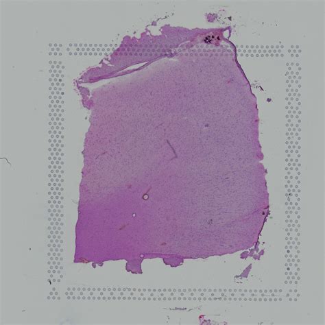 Spatiallibd An Rbioconductor Package To Visualize Spatially Resolved