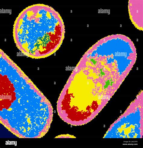 Escherichia Coli Coloured Transmission Electron Micrograph Tem Of A Colony Of Escherichia