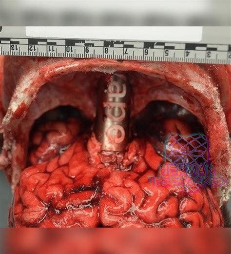 Florida Man Killed By Exploding Modified Vape Pen Rnsfl