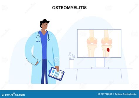 Tibia Bone Osteomyelitis Stock Illustration Illustration Of Surgery