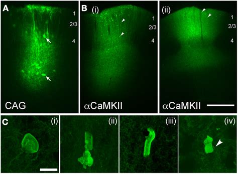 Axonal Swellings After Viral Mediated Expression Of Chr2 Ab