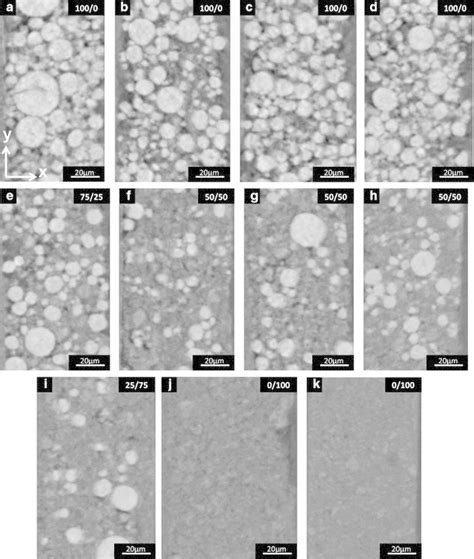 Gray Scale X Ray Attenuation Image Of A Cross Section Slice For Ad Nmc