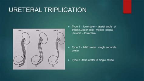 Intravenous Urogram Ivu Pptx