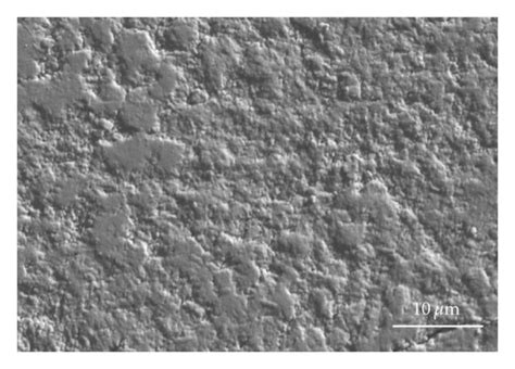 Sem Micrographs Of Untreated Enamel A Enamel Treated With Citric