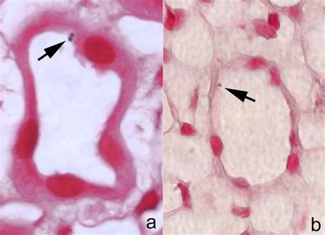 Single Crystal Formation In Imcd These 2 Photomicrographs Are From An