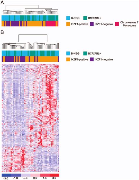 gene expression profile in b all patients a hierarchical clustering