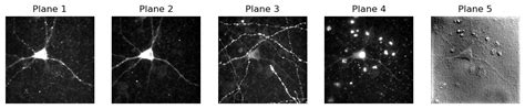 Python Pixel Size Dimensions Introduction To Bioimage Analysis