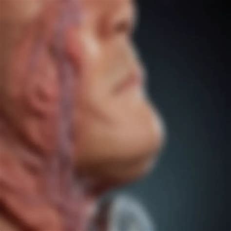 Dvt Prophylaxis Guidelines A Comprehensive Overview