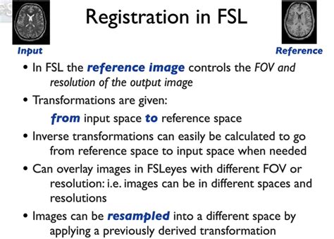 mri多序列，多中心数据集预处理 使用fsl flirt 配准数据 fsl flirt csdn博客