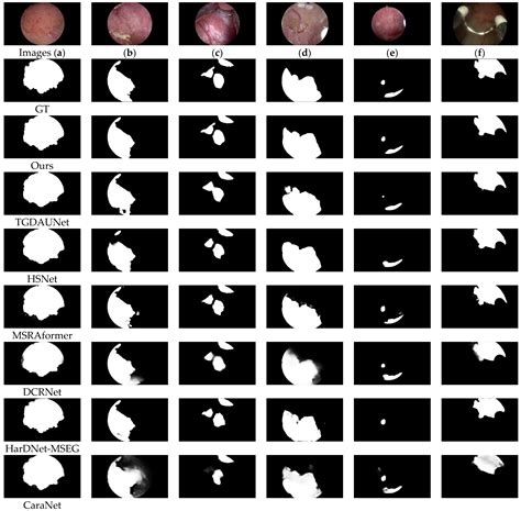 Mder Net A Multi Scale Detail Enhanced Reverse Attention Network For