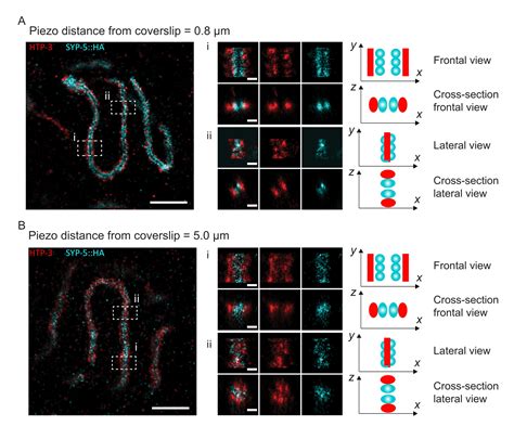 Super Resolution Microscopy Of The Synaptonemal Complex Within The Caenorhabditis Elegans Germline