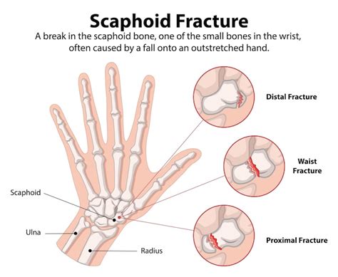 Scaphoid Fossa Scaphoid Fossa E Anatomy Imaios