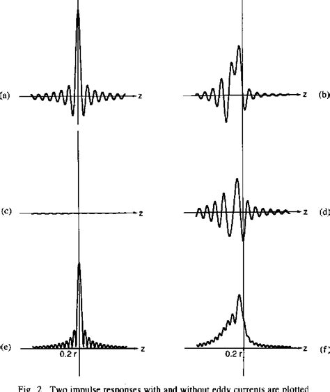 Figure 2 From Analysis Of The Eddy Current Induced Artifacts And The