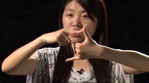 Terlahir Bisu Dan Tuli Wanita Ini Mendadak Bisa Bicara Setelah Menikah