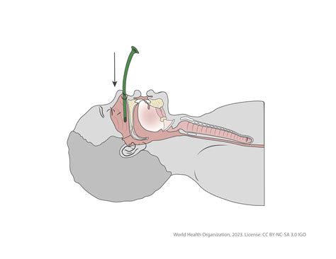 Image Library Open Critical Care