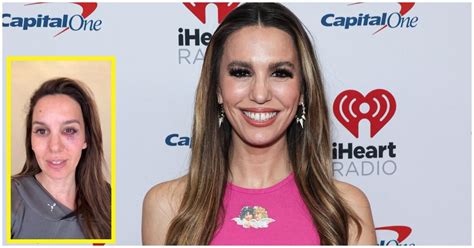 What Happened To Christy Carlson Romanos Face