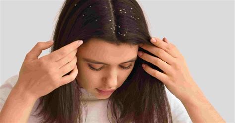 Ketoconazole Does This Anti Dandruff Shampoo Help In Hair Loss