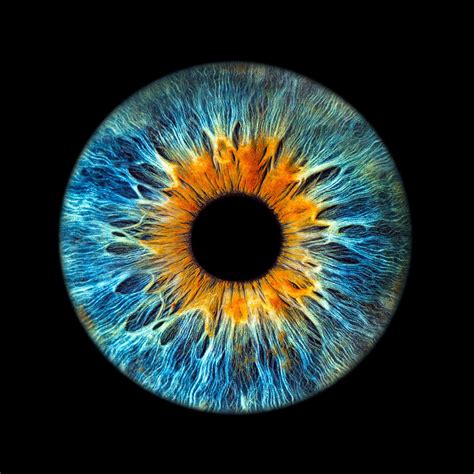 Iris Eye