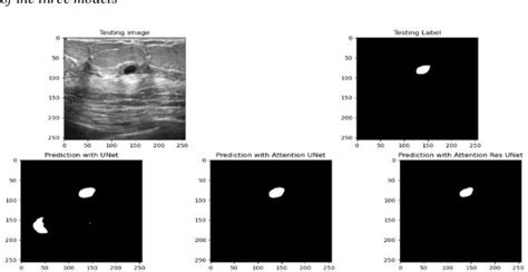 Figure 1 From Segmentation Of Cancer Masses On Breast Ultrasound Images Using Modified U Net