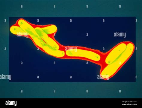 Mycobacterium Tuberculosis Coloured Transmission Electron Micrograph Tem Of The Bacteria