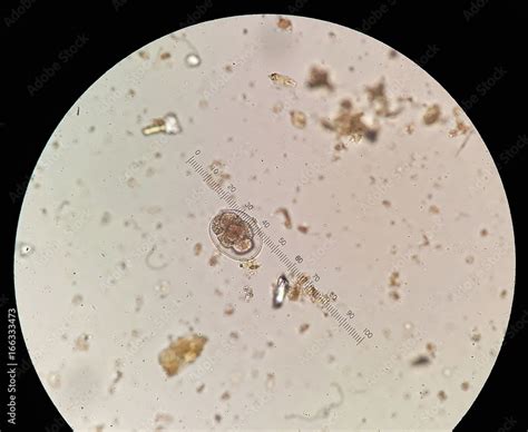 Hookworm Under Microscope