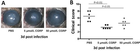 Exogenous Cgrp Treatment Alleviates The Inflammatory Reaction Of